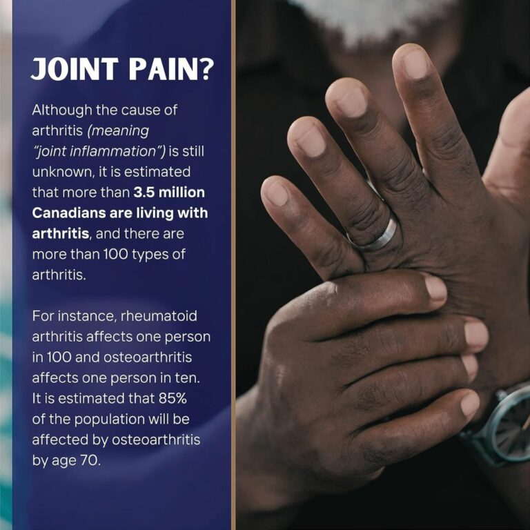 Buy Minard's Pain Relief Liniment - Your 24/7 Solution to Pain