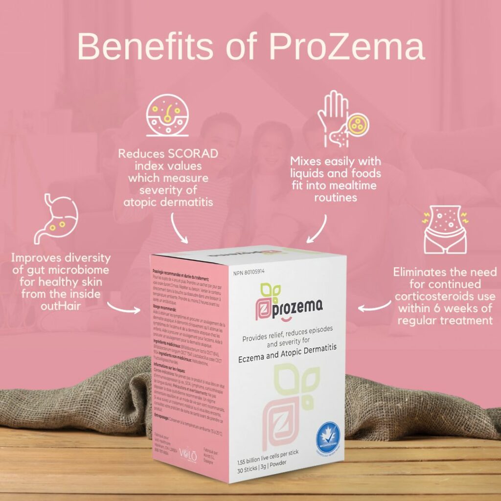 Buy Prozema Probiotic Supplement | Reduce The Symptoms Of Eczema