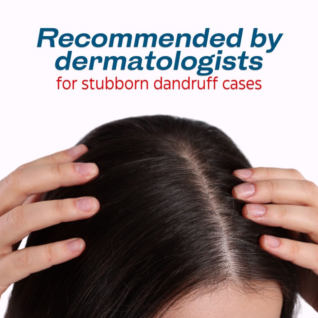 Buy Selsun Blue 2.5% Extra Strength Selenium Sulfide Lotion