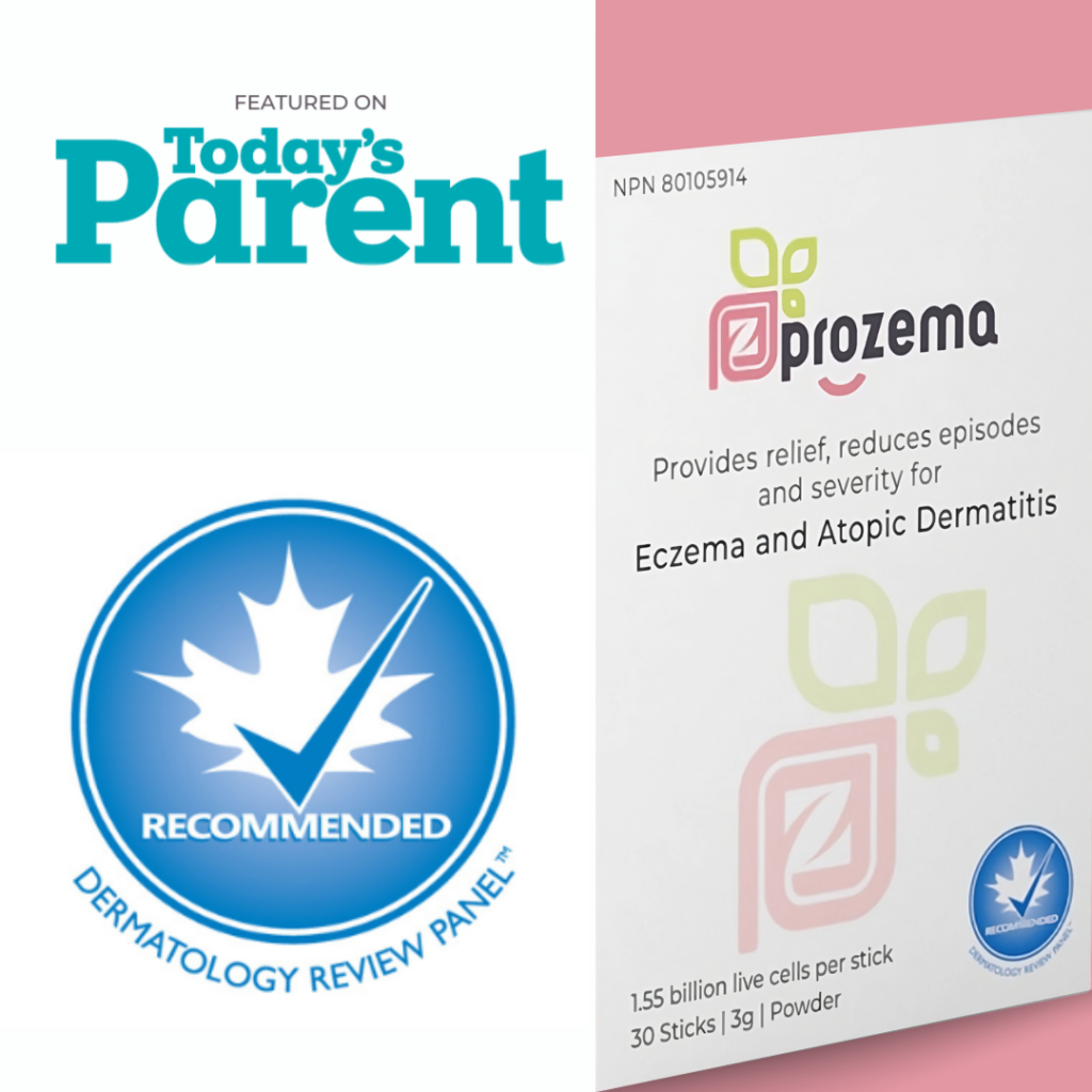Buy Prozema Probiotic Supplement | Reduce The Symptoms Of Eczema