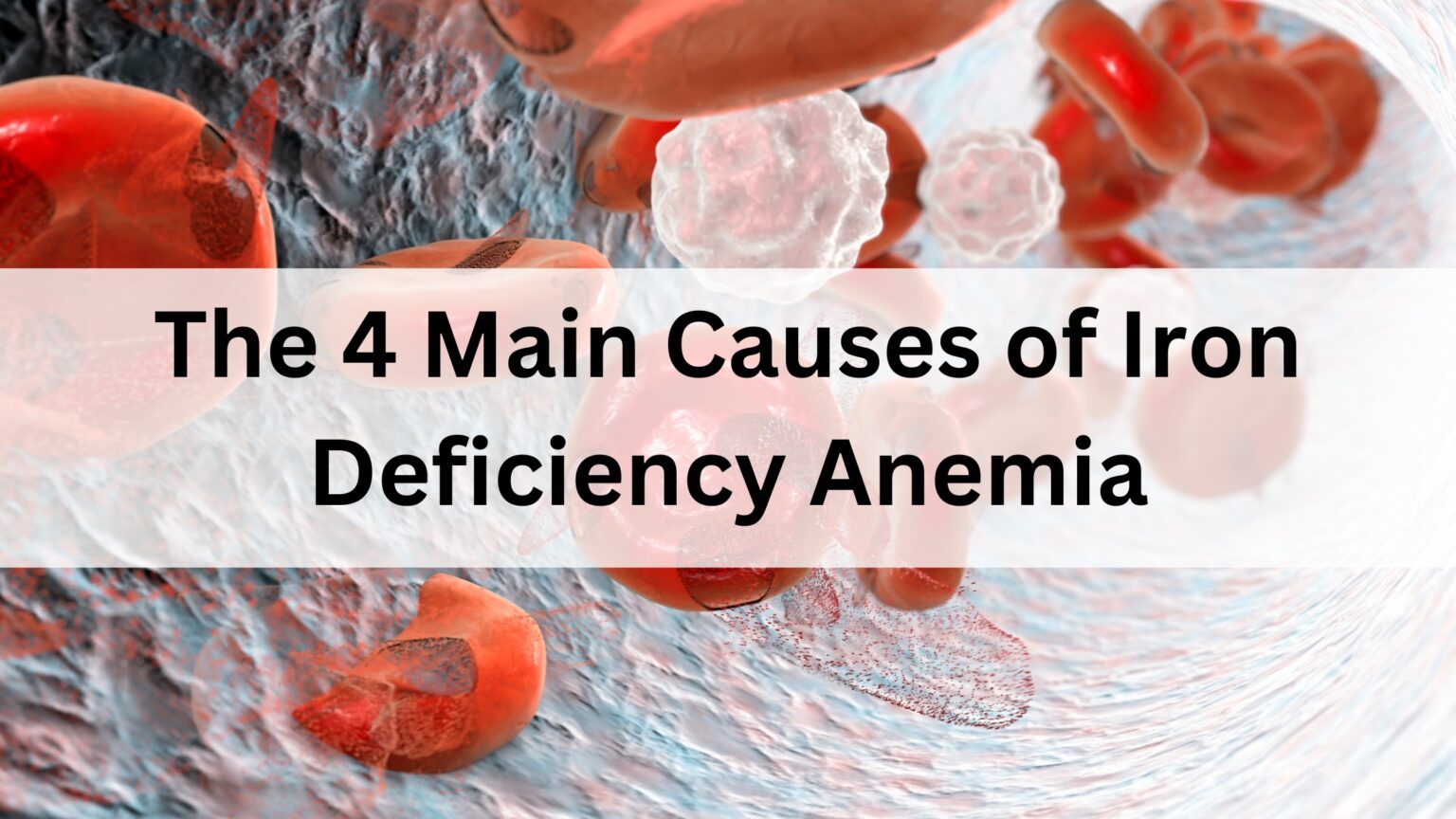 The 4 main causes of iron deficiency anemia and prevention