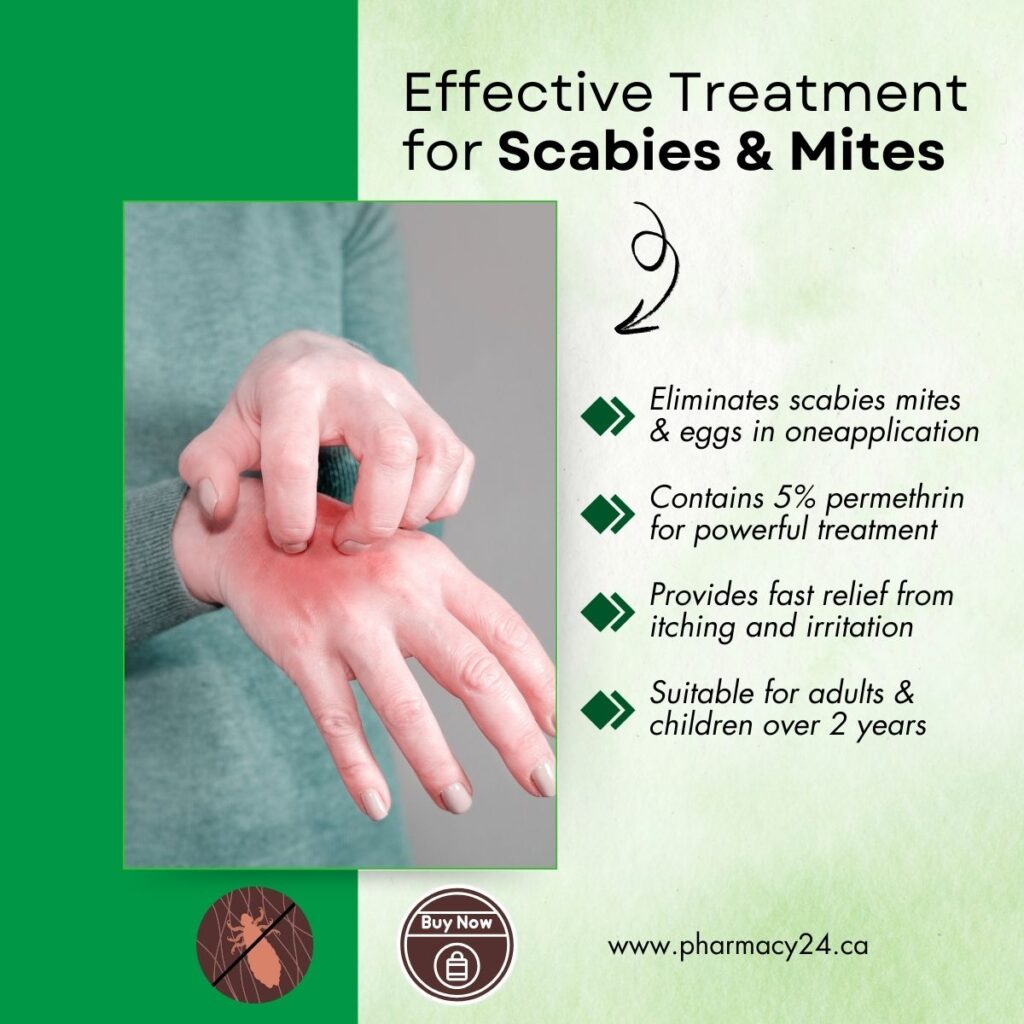 Buy Nix Dermal Cream 30g [Permethrin 5%] - Pharmacy24®