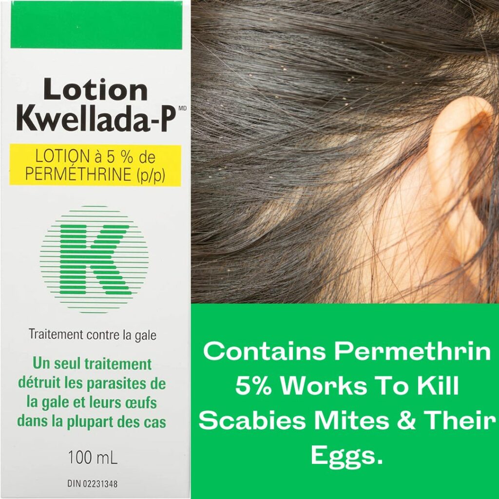 Buy Kwellada P Lotion [5% Permethrine] | Get Fast Relief from Scabies