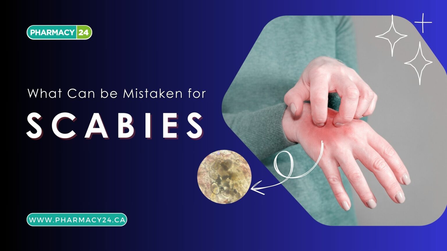 What Can be Mistaken for Scabies | A 2025 Guide to Differential Diagnosis