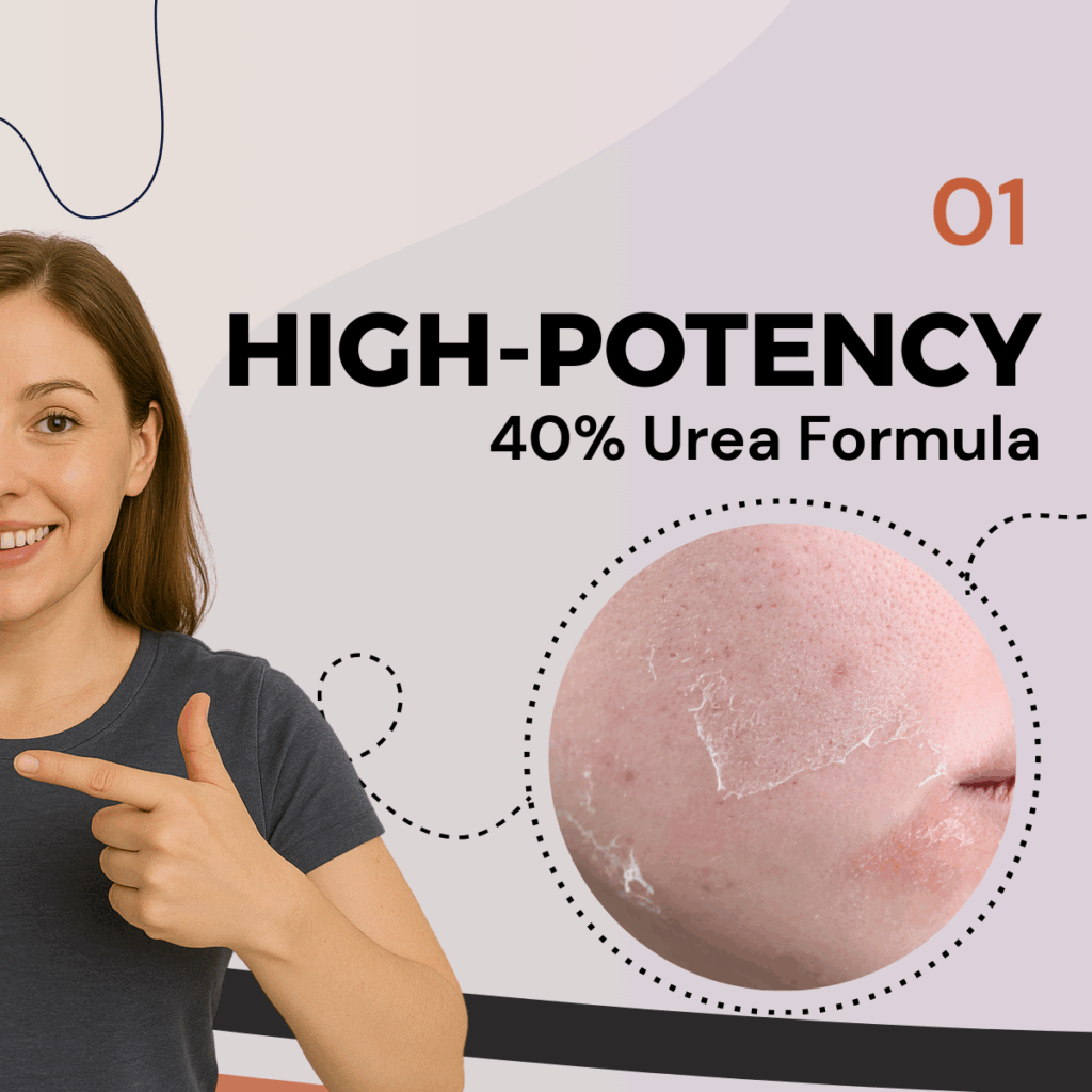 Buy Urisec® 40% Cream for Severe Dry Skin & Nail Repair