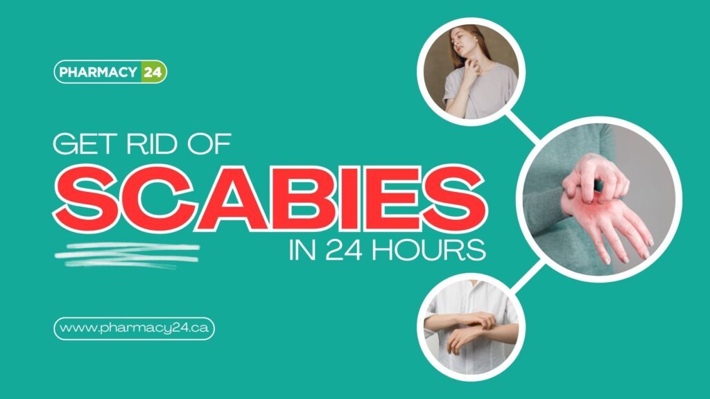 How to Get Rid of Scabies in 24 Hours | Fast and Effective Solutions